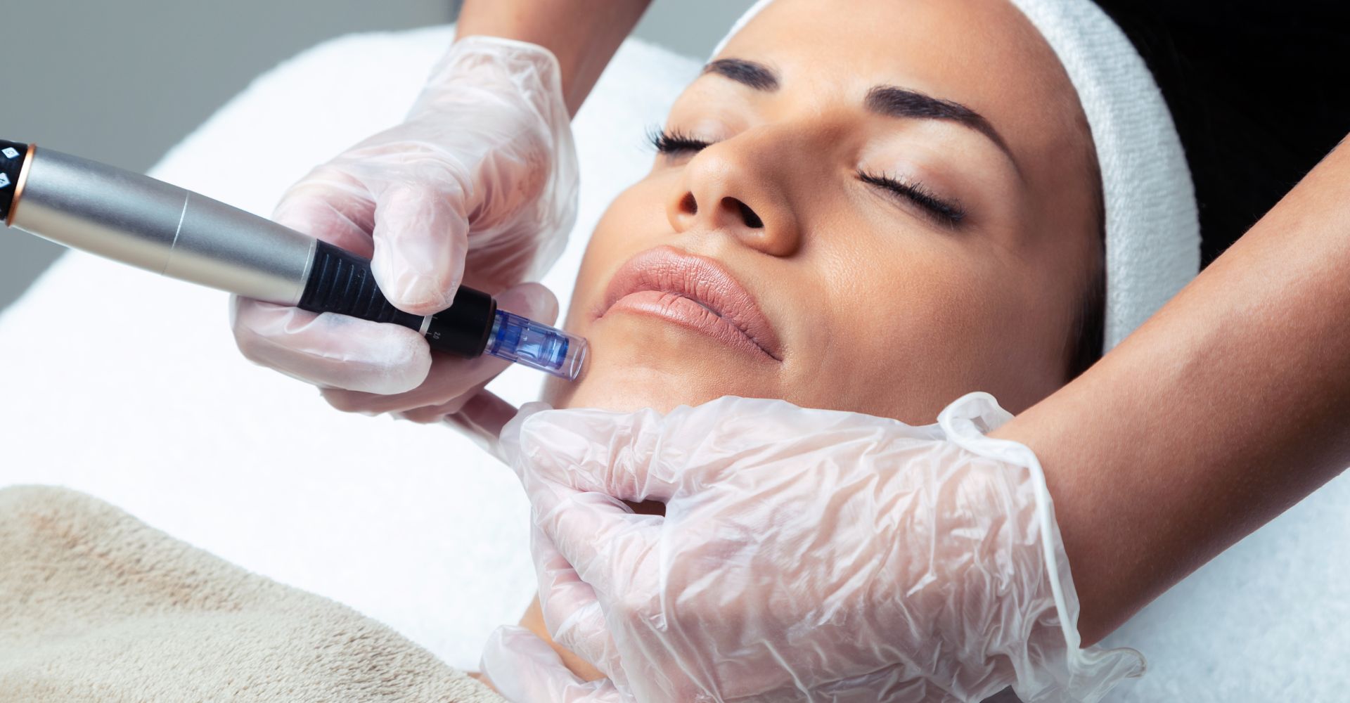 Can You Do Microneedling At Home? - Refined Skin Club
